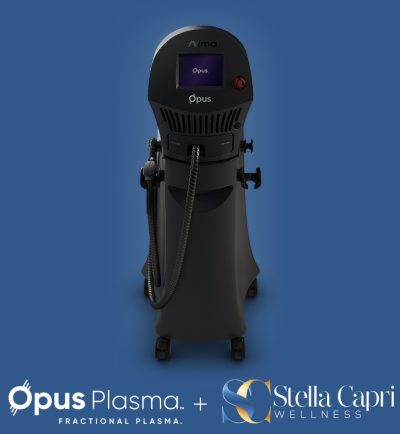 Opus Plasma - Stella Capri